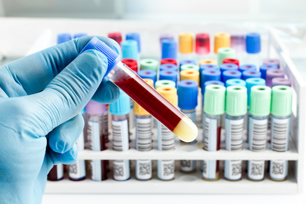 Regular Blood Testing Getting The Real Score Of Your Wellness Game 